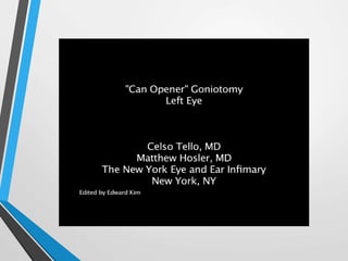 Trabeculectomy, trabeculotomy, goniotomy and their complications | PPTX