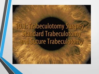 Trabeculectomy, trabeculotomy, goniotomy and their complications | PPTX