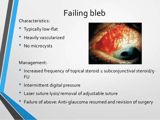 Trabeculectomy, trabeculotomy, goniotomy and their complications