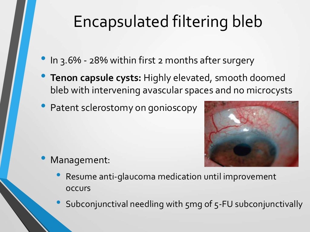 Trabeculectomy, trabeculotomy, goniotomy and their complications