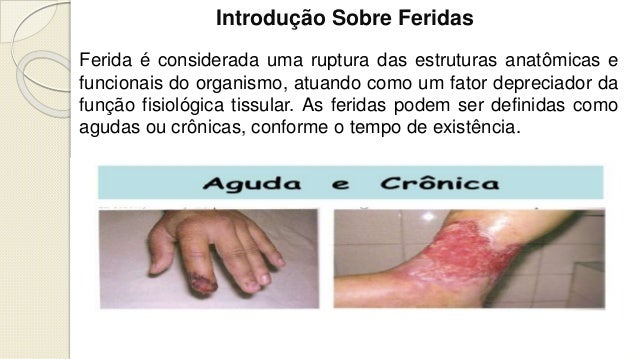 Trabalho sobre feridas