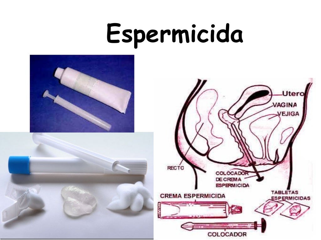 Metodos Contraceptivos