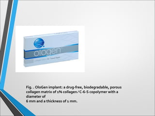 Glaucoma Filtration Surgery Study | PPT