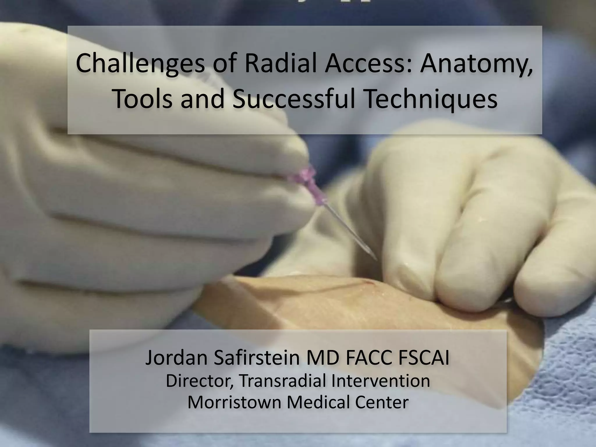 Transradial access and challenges edited 10 5-15 | PPTX | Medical Health