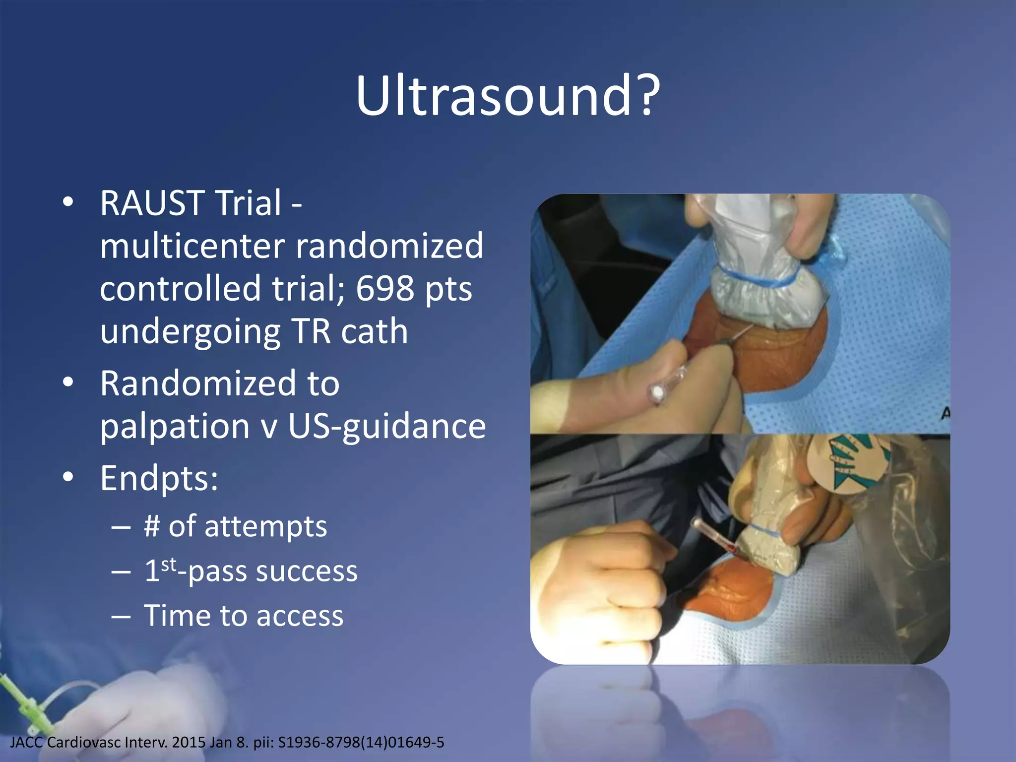 Transradial access and challenges edited 10 5-15 | PPTX | Medical Health