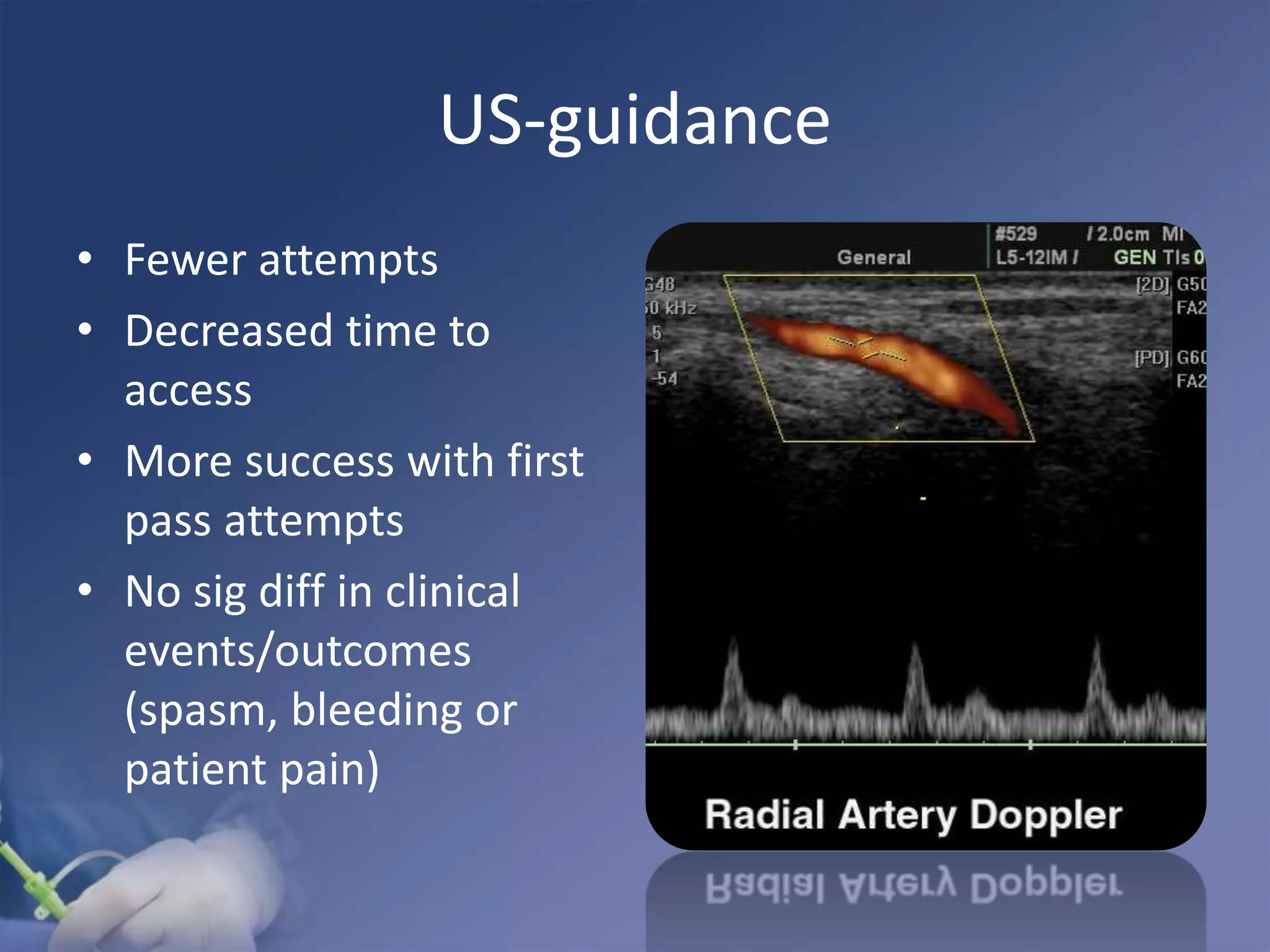 Transradial access and challenges edited 10 5-15 | PPTX | Medical Health