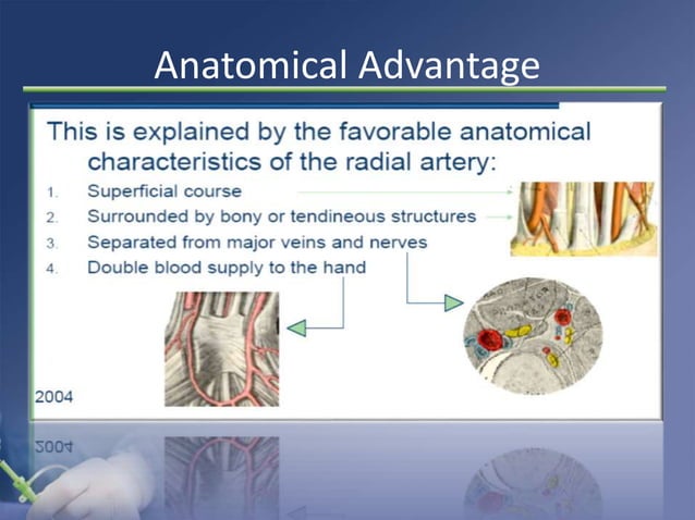 Transradial access and challenges edited 10 5-15 | PPT