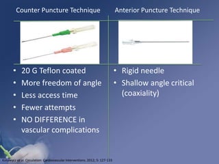 Transradial access and challenges edited 10 5-15 | PPTX | Medical Health