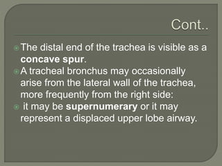 trachea,and bronchi, upper respiratory | PPTX