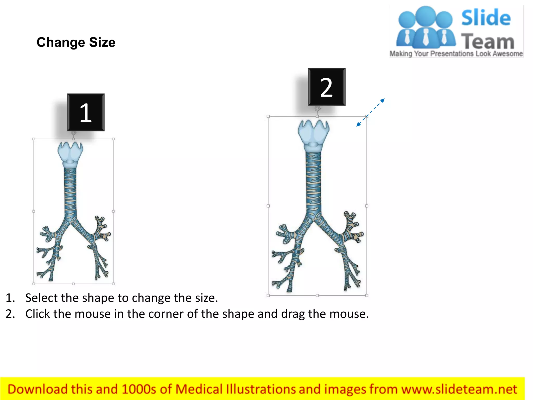 Trachea and divisions medical images for power point | PDF