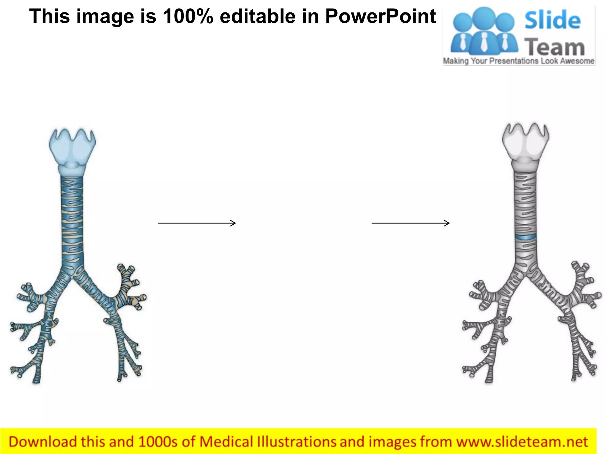 Trachea and divisions medical images for power point | PDF