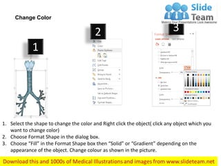 Trachea and divisions medical images for power point | PDF