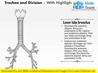Trachea and divisions medical images for power point | PDF