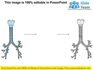 Trachea and divisions medical images for power point | PDF