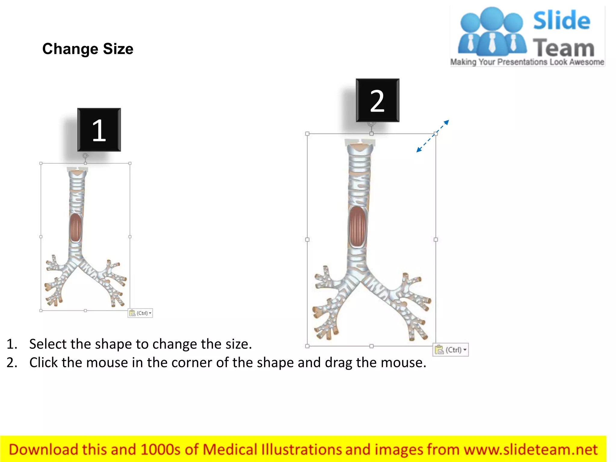 Trachea and major bronchi anterior view medical images for power point ...