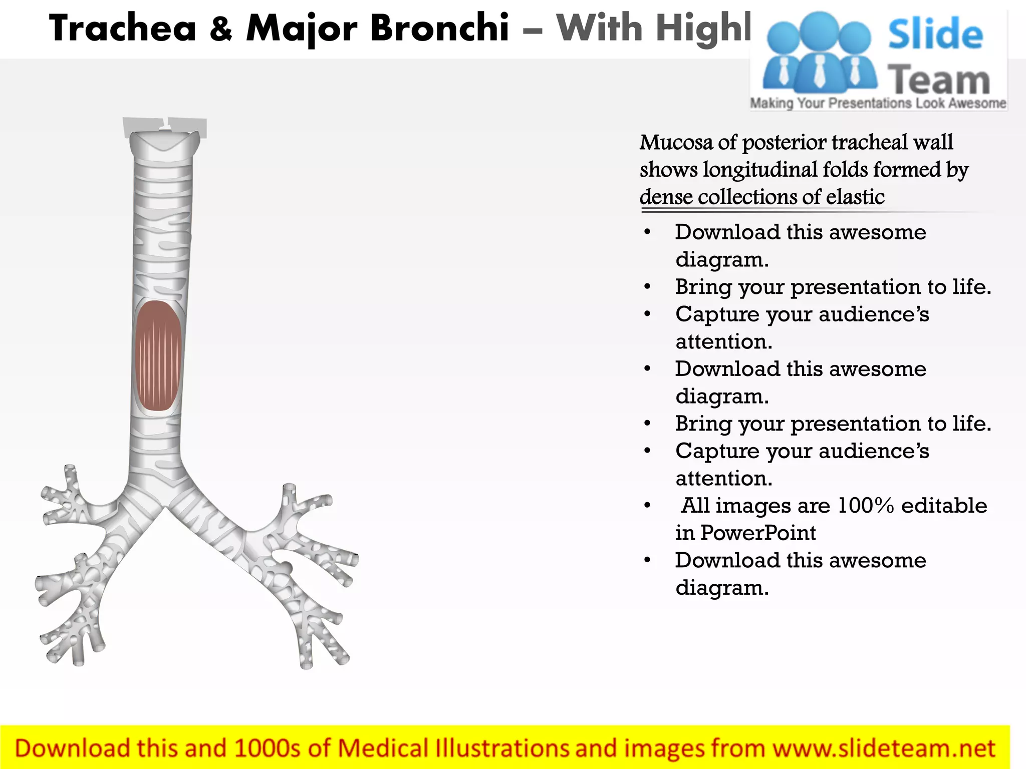 Trachea and major bronchi anterior view medical images for power point ...