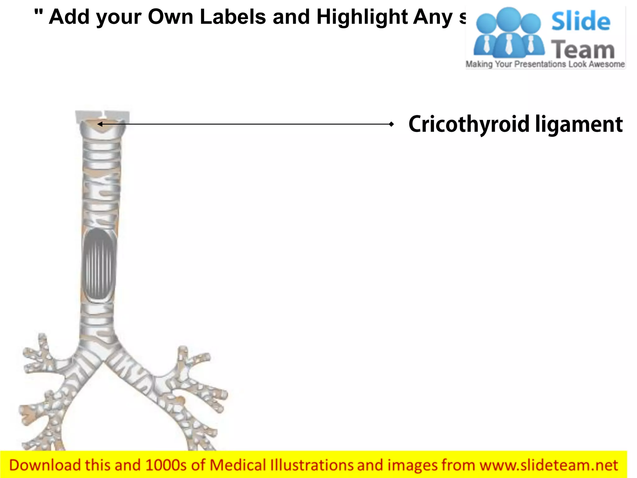 Trachea and major bronchi anterior view medical images for power point ...