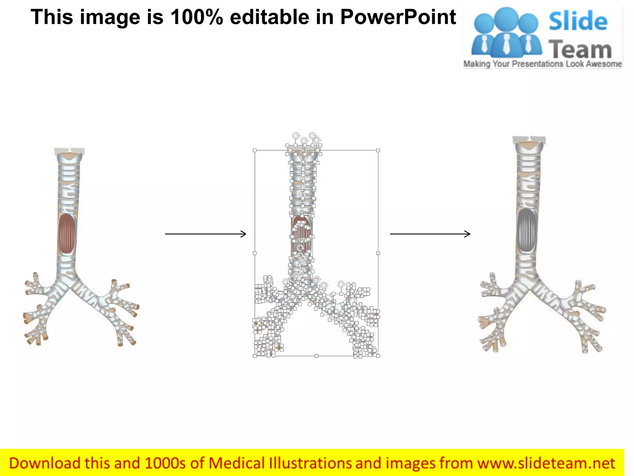 Trachea and major bronchi anterior view medical images for power point ...