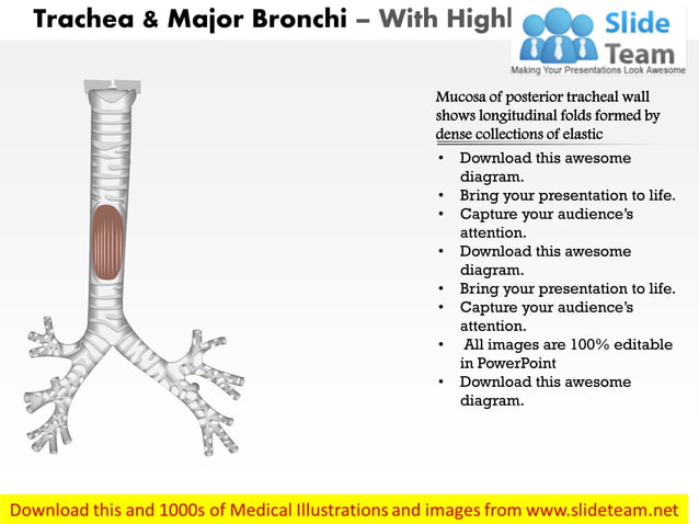 Trachea and major bronchi anterior view medical images for power point ...