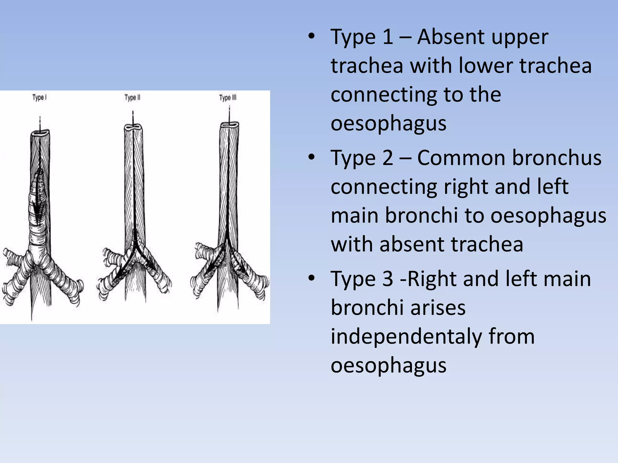 Tracheal pathologies | PPTX