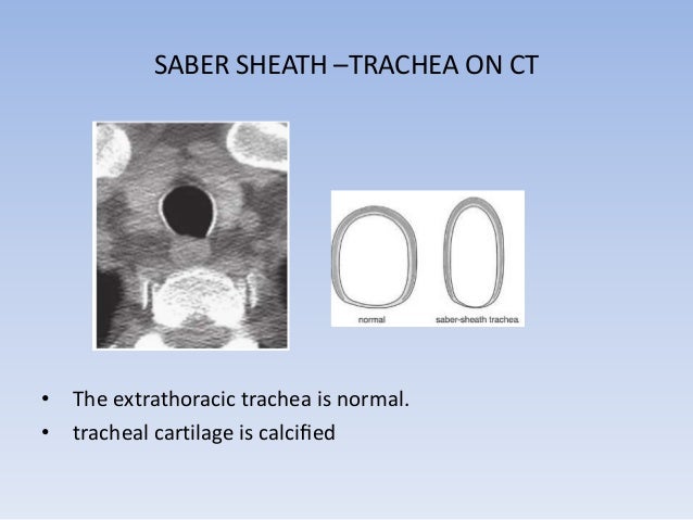 Tracheal pathologies