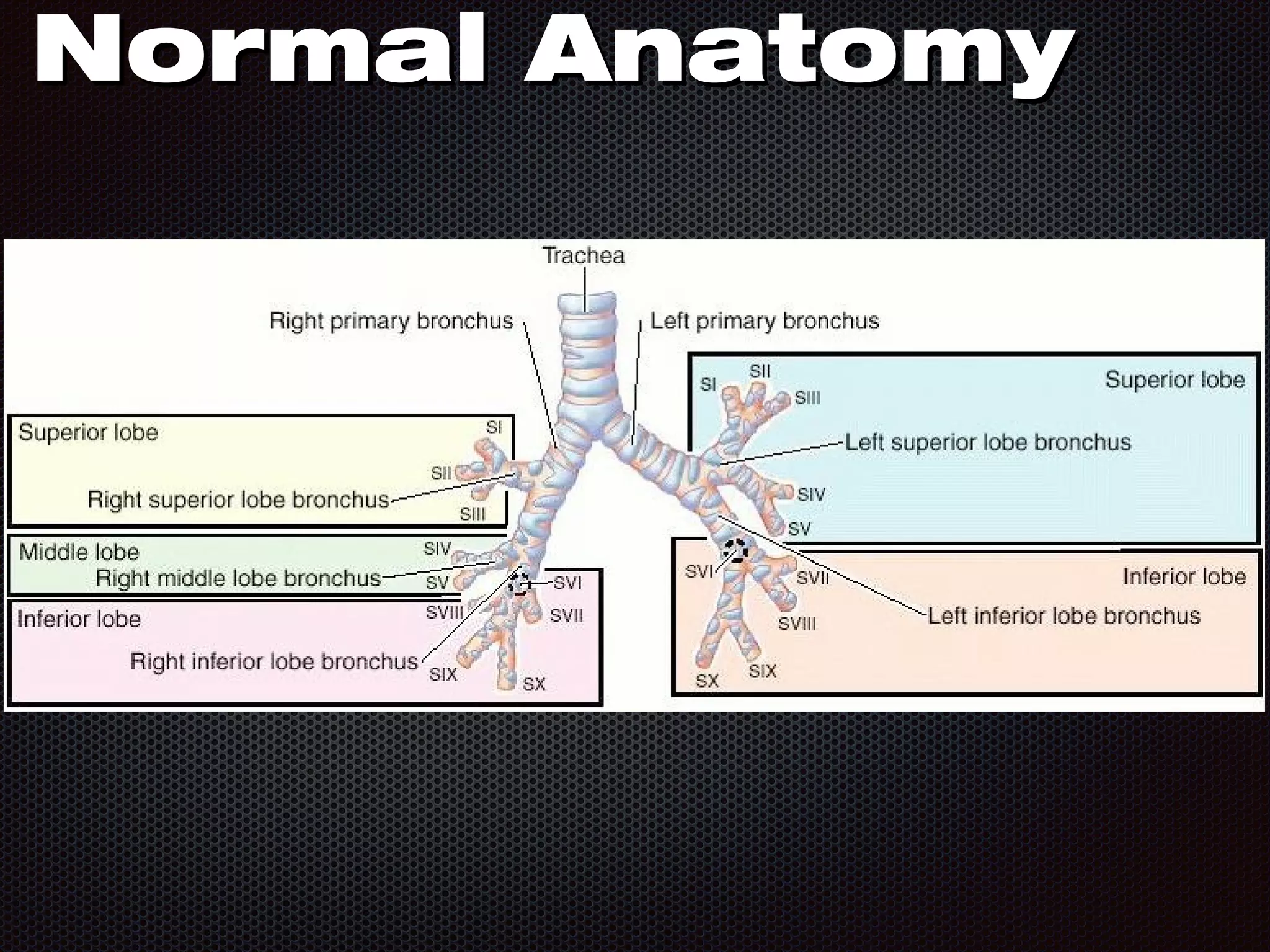 Tracheal bronchus slide | PPT