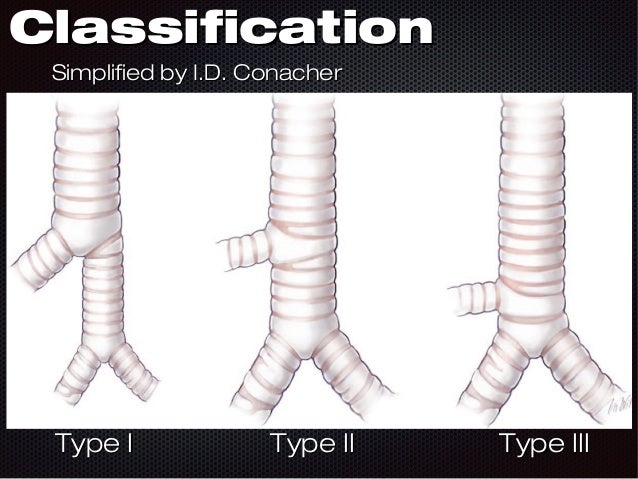 Tracheal bronchus slide