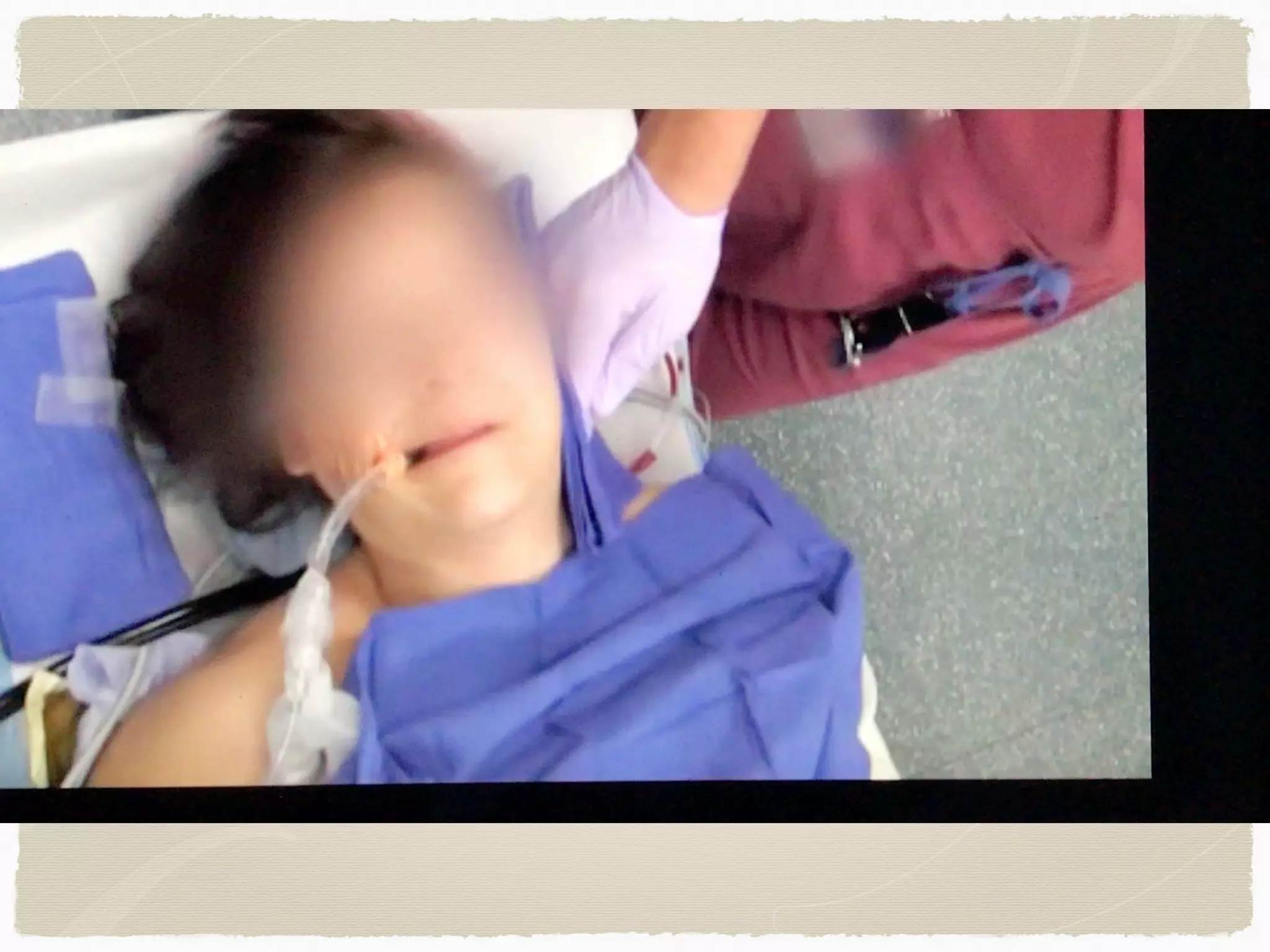 Tracheal extubation lecture | PDF | Ear, Nose and Throat Conditions | Diseases and Conditions