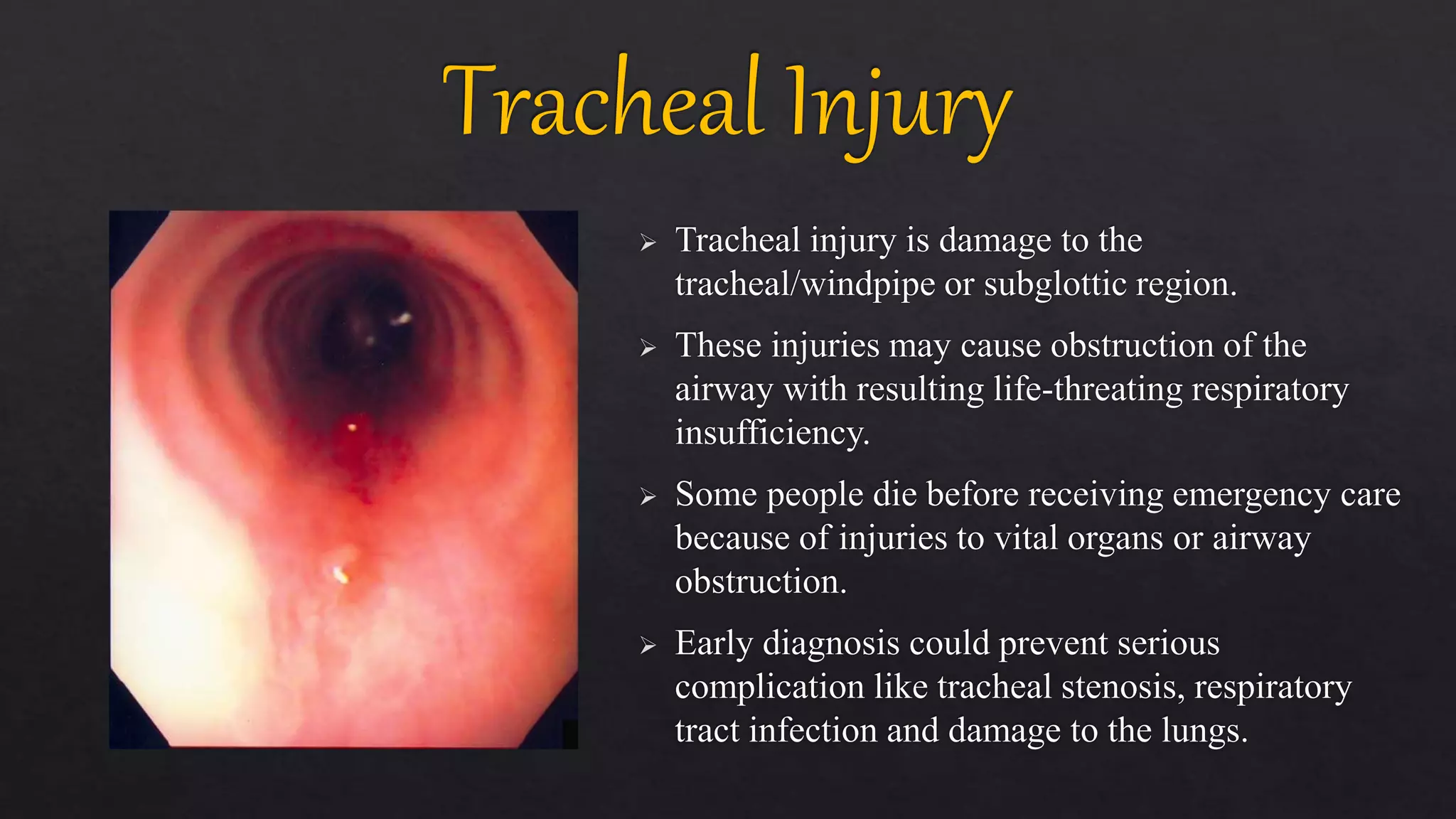 Tracheal injury & stenosis | PPTX