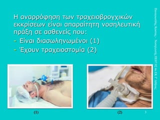 Αναρρόφηση τραχείας | PPTX