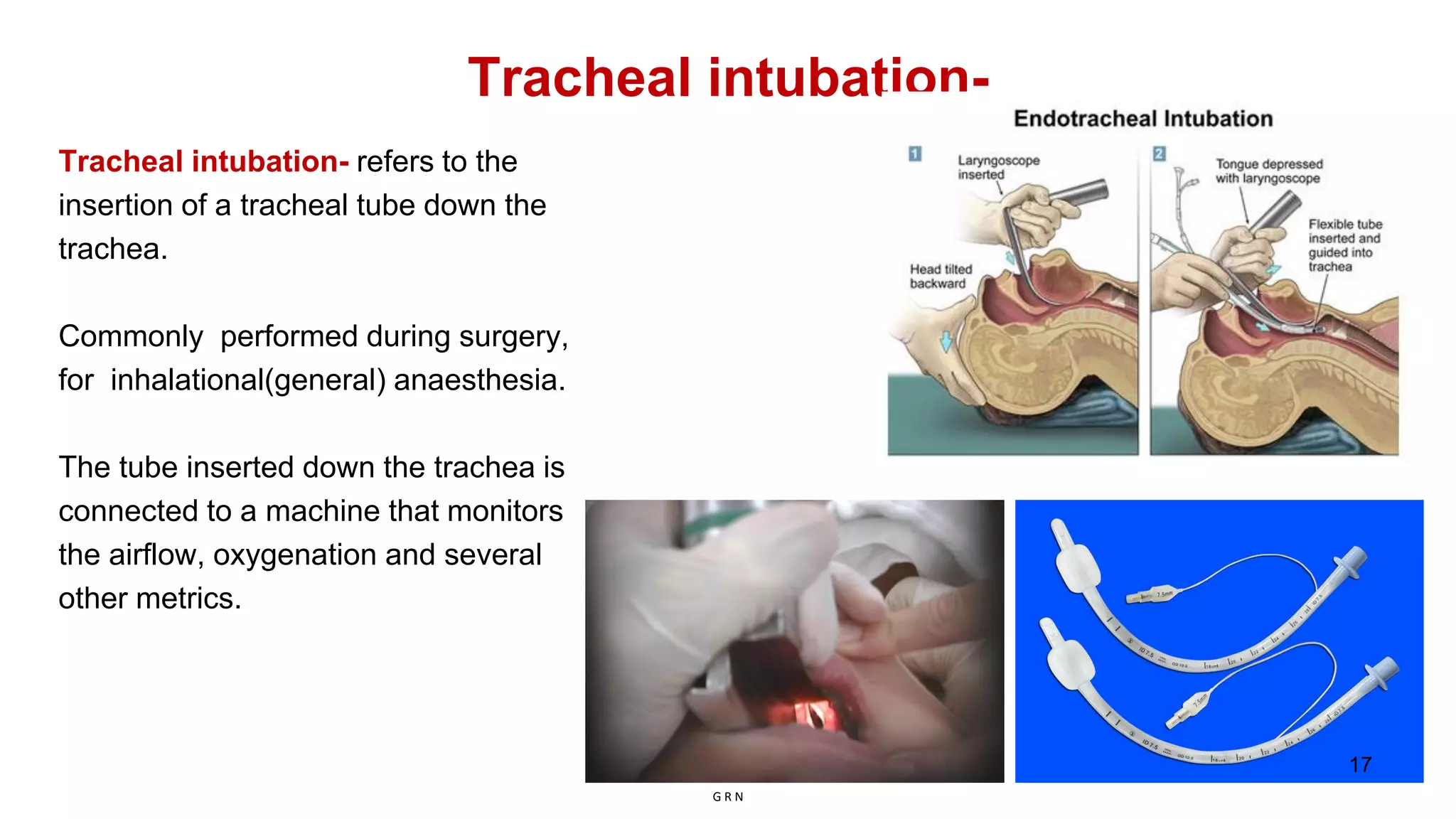 Trachea, oesopha & thoracic duct r | PDF