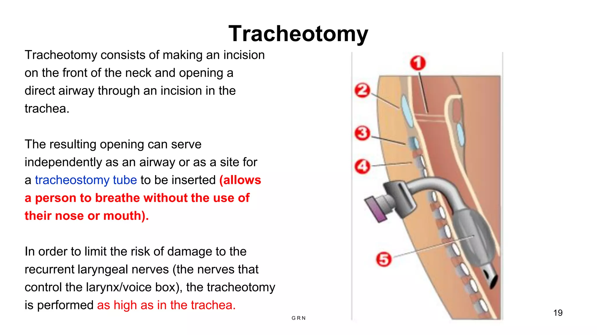 Trachea, oesopha & thoracic duct r | PDF