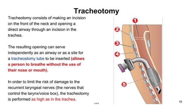 Trachea, oesopha & thoracic duct r | PDF | Thyroid Disorders ...