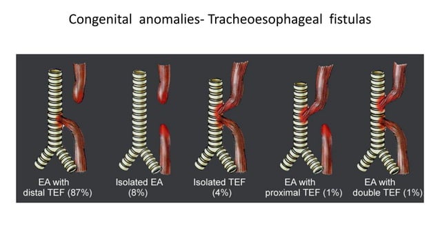 Trachea, oesopha & thoracic duct r | PDF | Thyroid Disorders ...