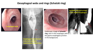 Trachea, oesopha & thoracic duct r | PDF