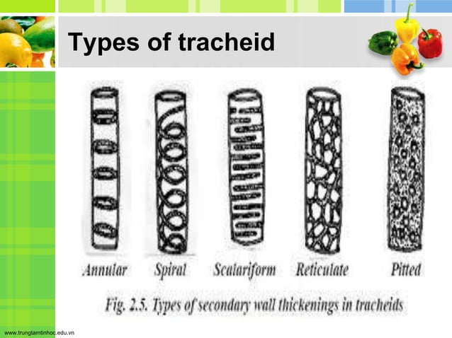 Tracheid and vessel elements | PPTX | Lung and Respiratory Health ...