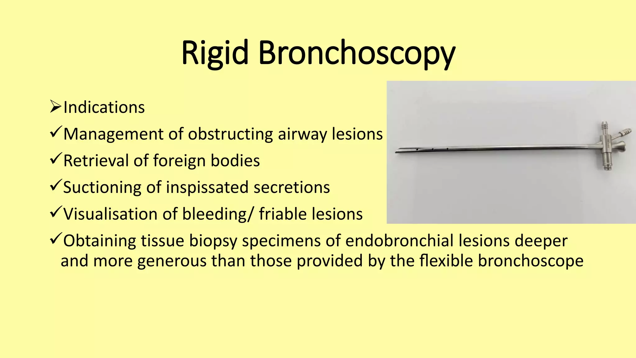 Tracheobronchial tree anatomy and bronchoscopy | PPTX