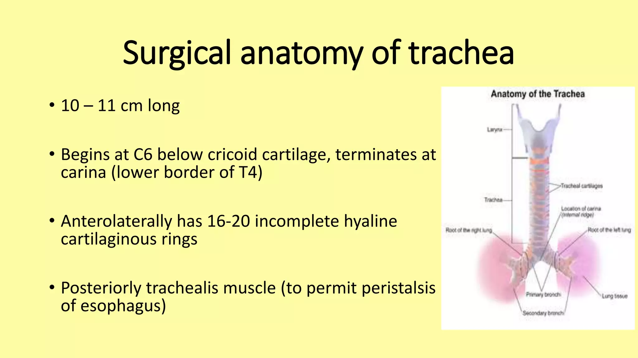 Tracheobronchial tree anatomy and bronchoscopy | PPTX