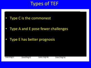Anesthesia for Tracheoesophageal fistula | PPTX