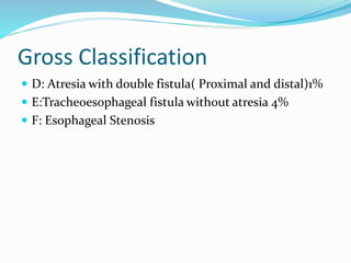 Tracheoesophageal fistula | PPTX