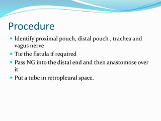 Tracheoesophageal fistula | PPTX