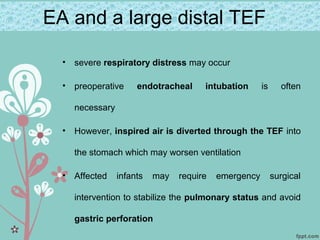 Tracheoesophageal fistula | PPT