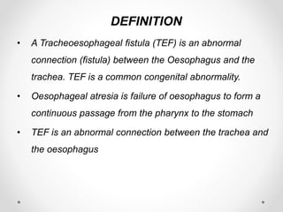Tracheoesophageal fistula | PPTX