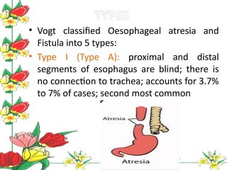 TRACHEOESOPHAGEAL FISTULA hbmjgffddddffg | PPTX