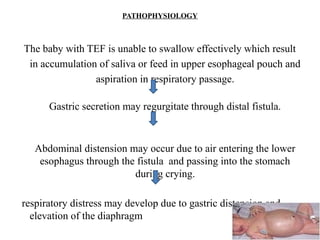 Tracheoesophageal fistula for bsc nursing | PPTX