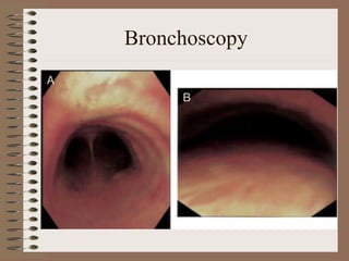 Tracheomalacia Bronchoscopy