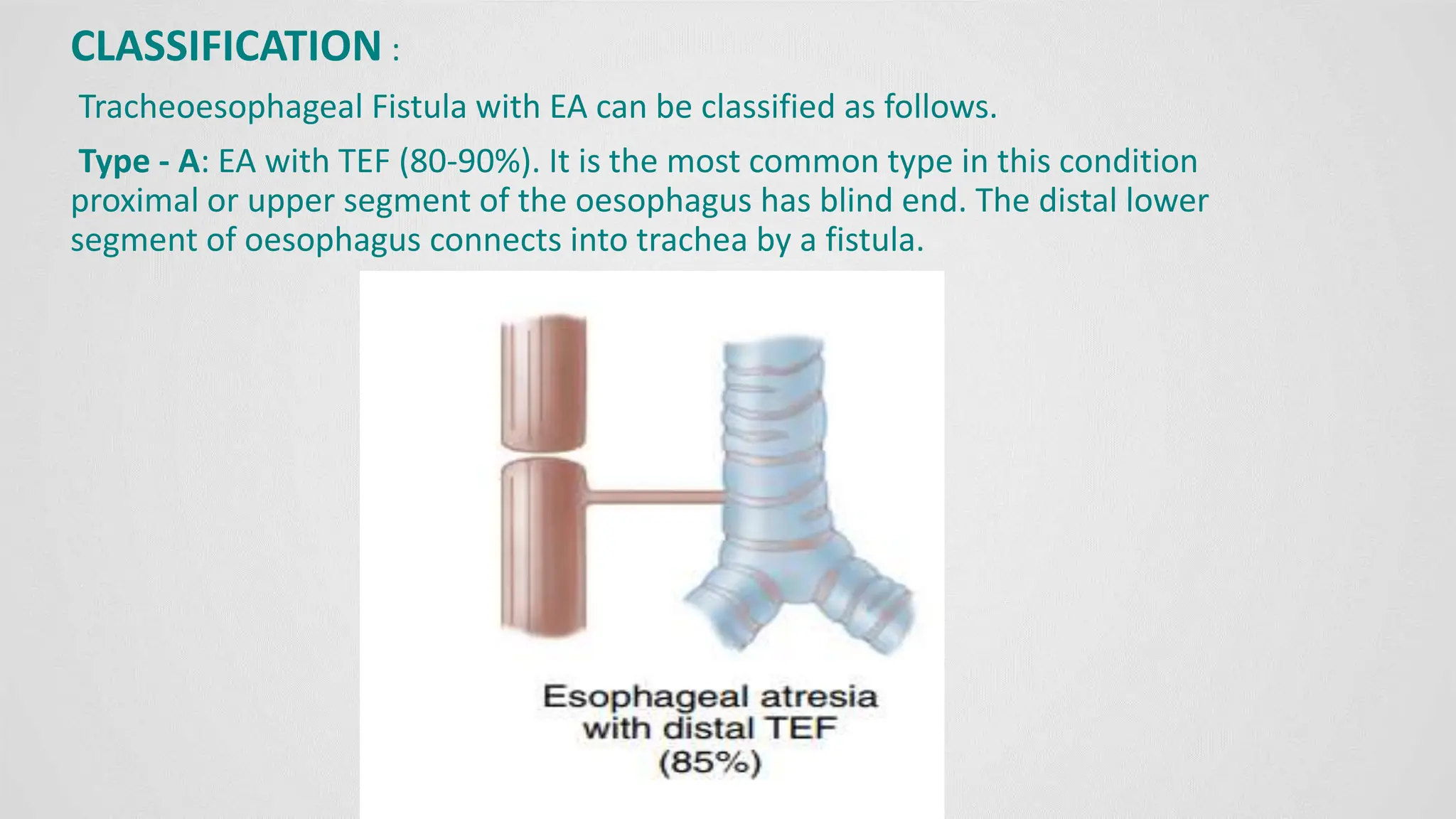 TRACHEOSPHAGEAL FISTULA.pptx an abnormalities | PPTX | Ear, Nose and ...