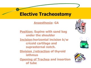 E.N.T.Tracheostomy.(dr.usif chalabe) | PPT