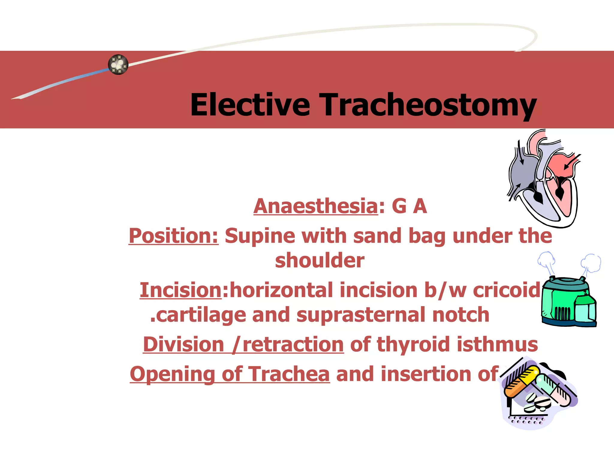 Tracheostomy | PPT