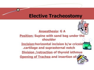 Tracheostomy | PPT